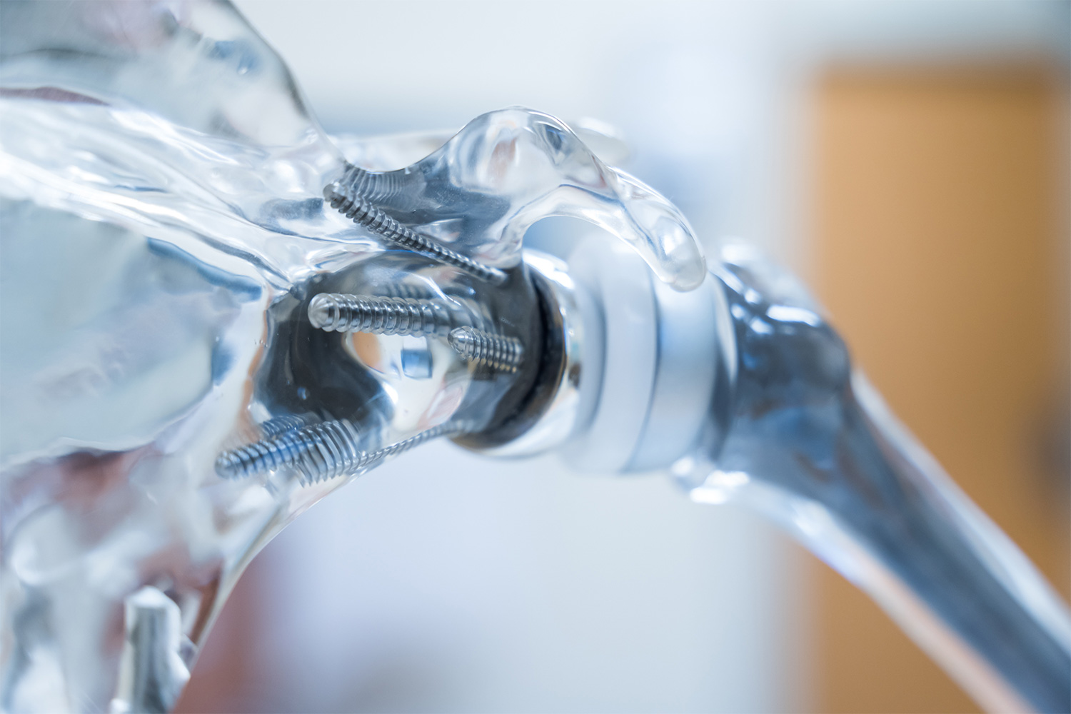 Joint Replacement - Orthopedic Partners